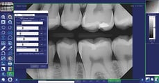 Top 9 Dental Imaging Software [Compared]: Reviews & Rating