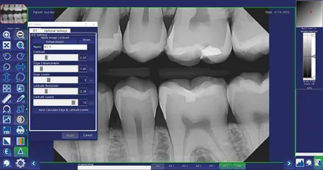 Top 10 Dental Imaging Software [Compared]: Reviews & Rating